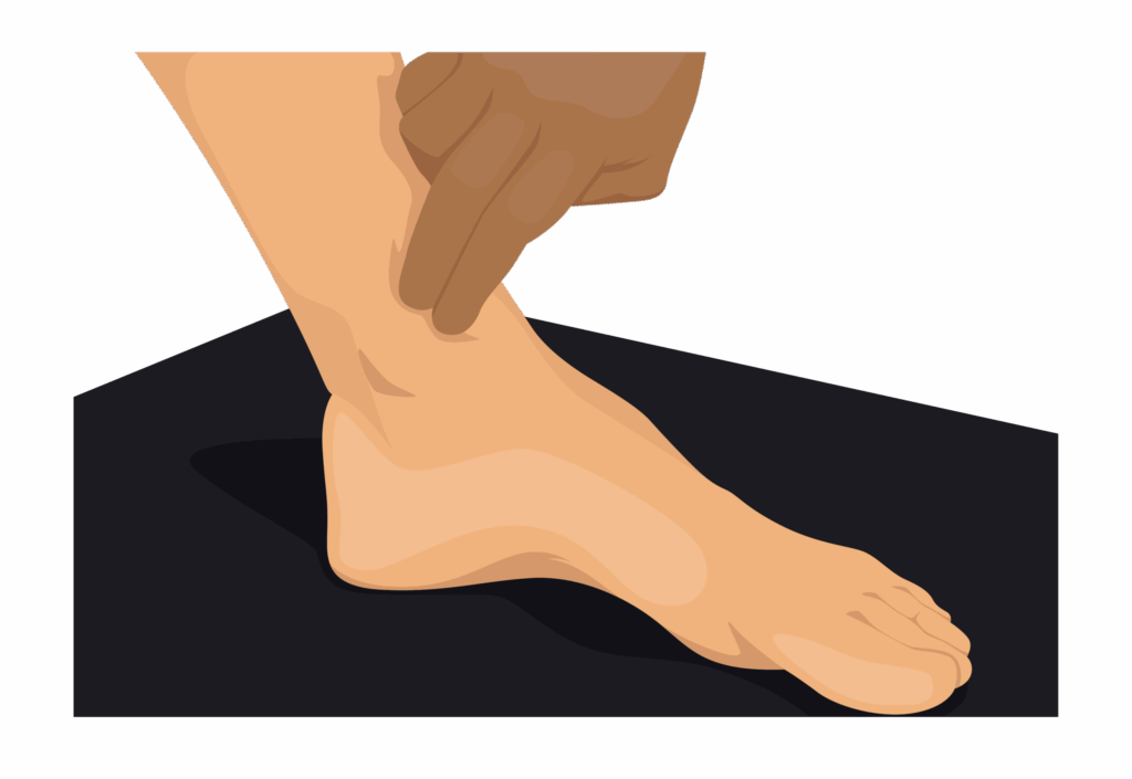 Tinel’s Sign (Ankle)