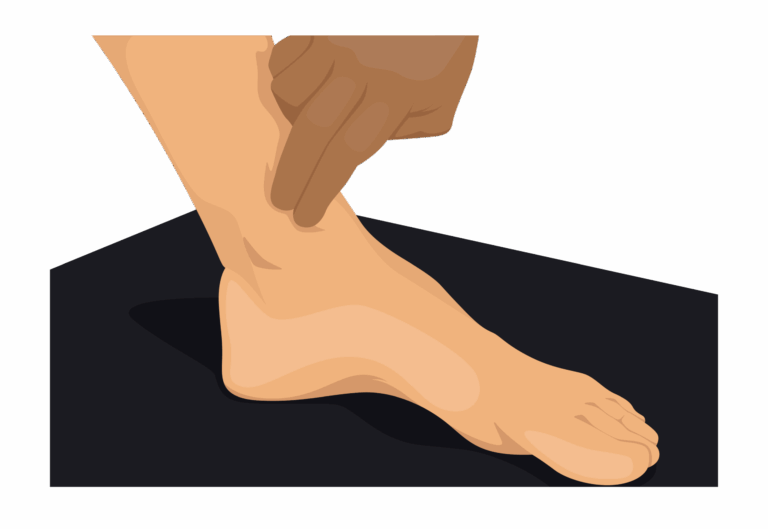Tinel’s Sign (Ankle)