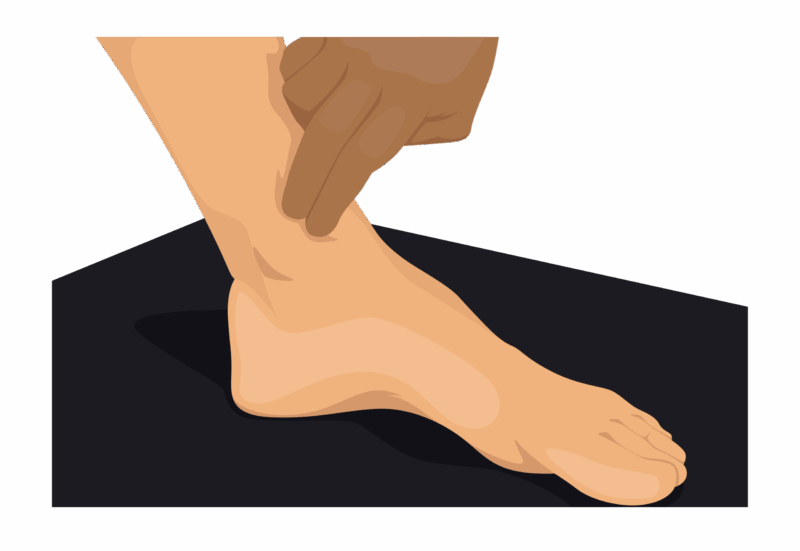 Tinel’s Sign (Ankle)